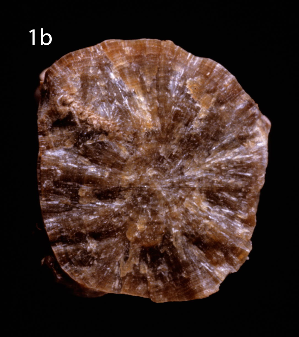 Randall’s plaque as the origin of idiopathic calcium oxalate stone ...